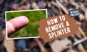 11 Hacks on How To Remove a Splinter - Without Using Tweezers