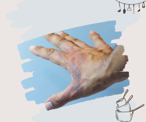 How to Treat a Burn on Hand From Hot Pan - Symptoms, First Aid and ...