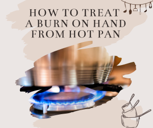 How to Treat a Burn on Hand From Hot Pan - Symptoms, First Aid and ...